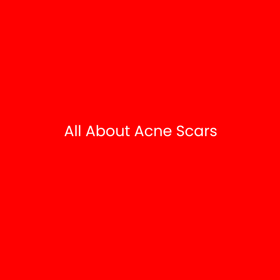 All About Acne Scars – HOO Dermatology