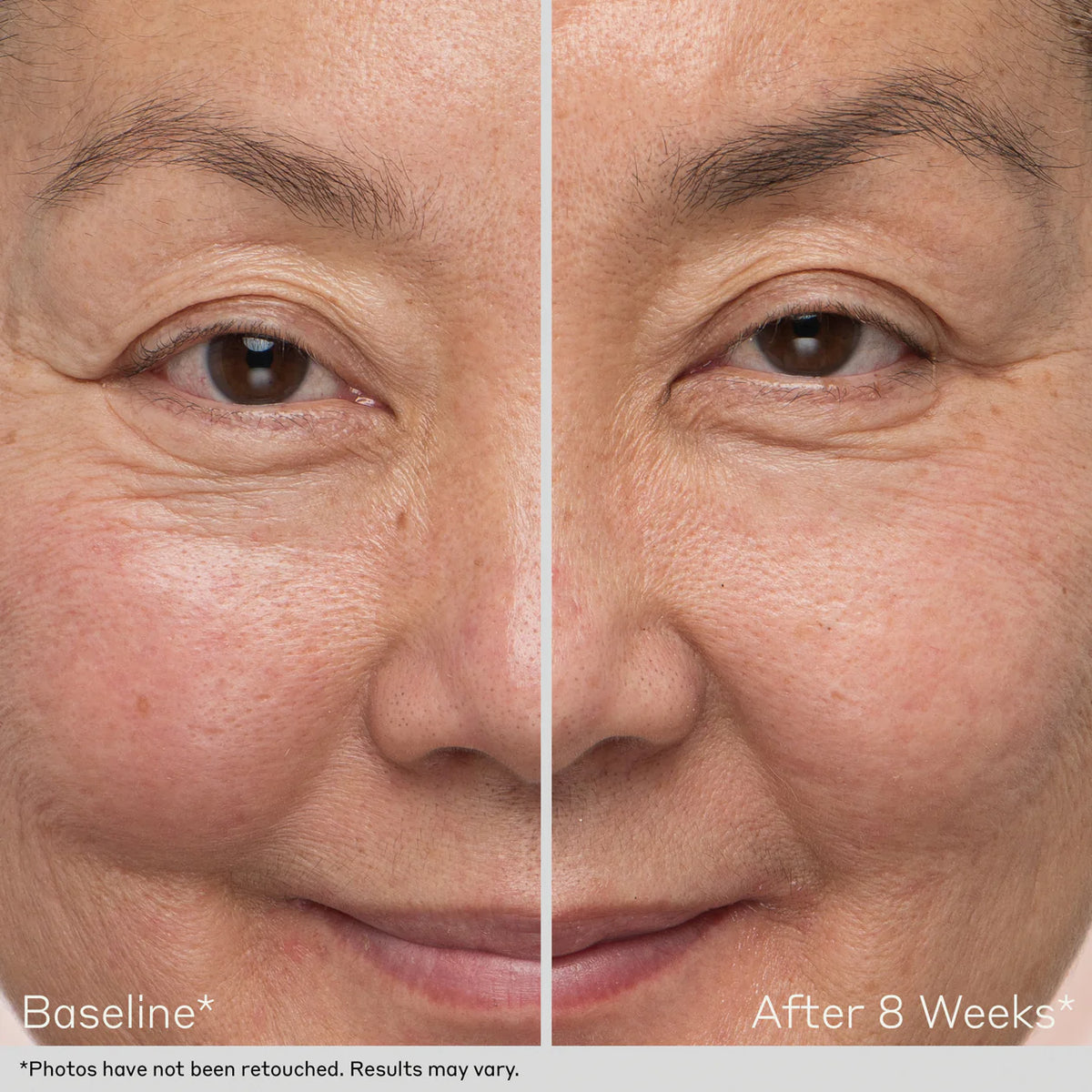 Obagi Nu-Cil Eyebrow Boosting Serum | HOO Dermatology